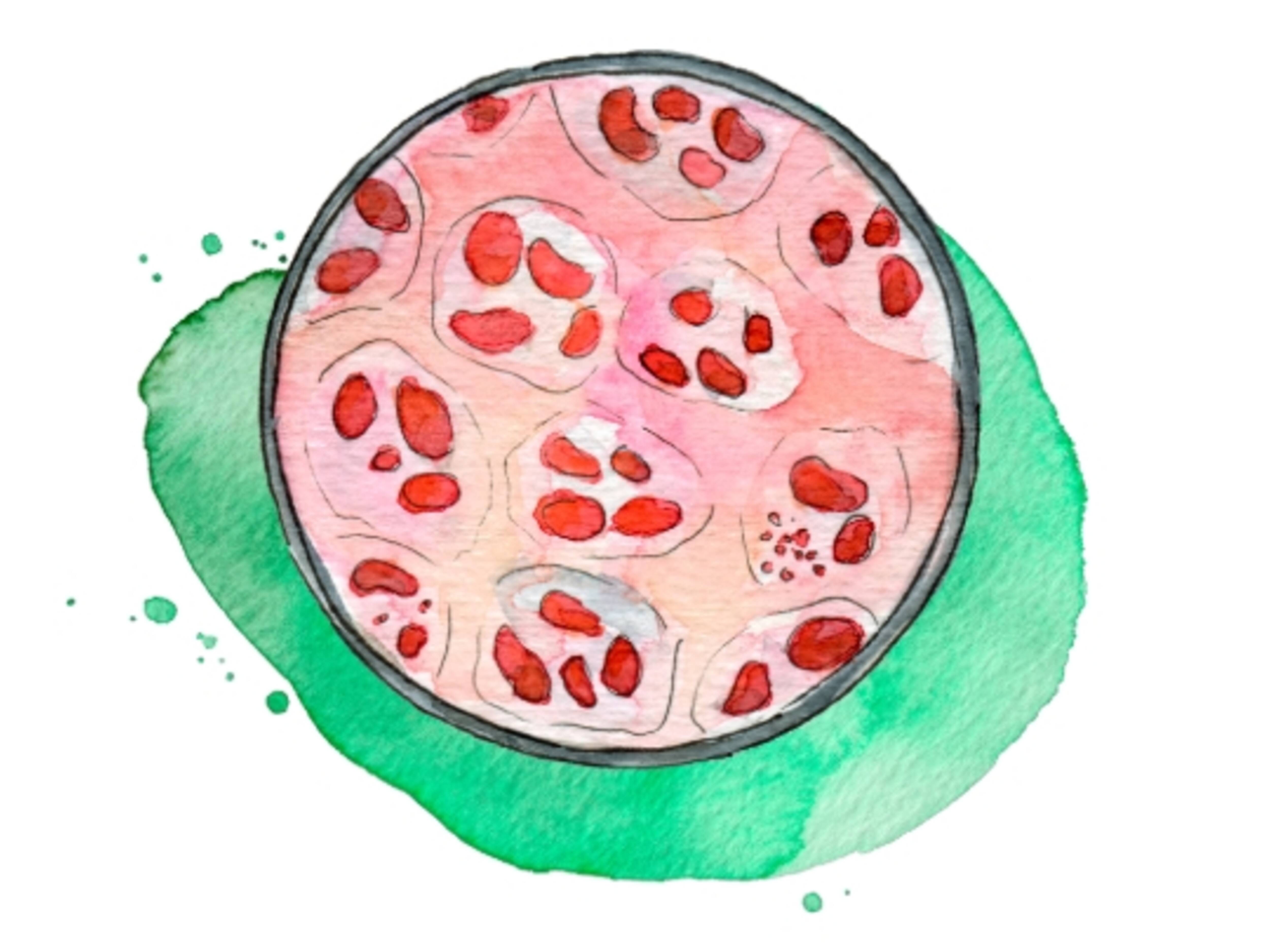 Medorrhinum: der Wirkstoff in der Homöopathie